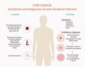 Can Lyme Disease Be Cured? - Know More In Details
